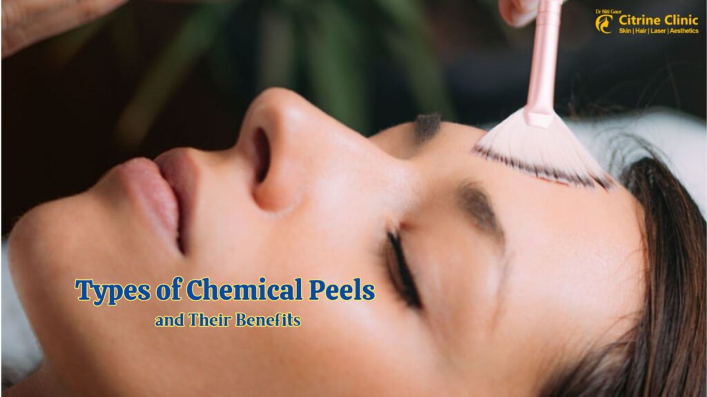 Types of Chemical Peels and Their Benefits - Networkblogworld.com
